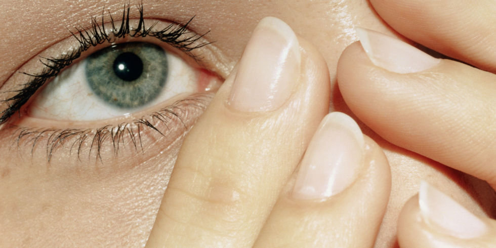 Cyst on Nose - Causes, Treatment, Removal, Pictures