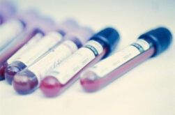 Paraproteinemia Definition, Symptoms, Causes, Treatment