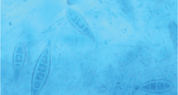 Microsporum Canis Pictures, Symptoms, Causes, Transmission, Treatment