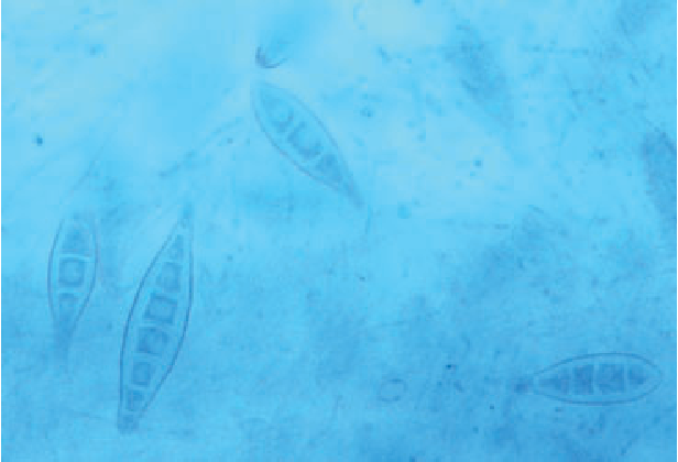 Microsporum Canis Pictures, Symptoms, Causes, Transmission, Treatment