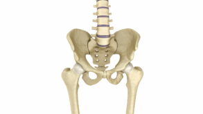 Platypelloid Pelvis Definition, Symptoms, Causes, Treatment