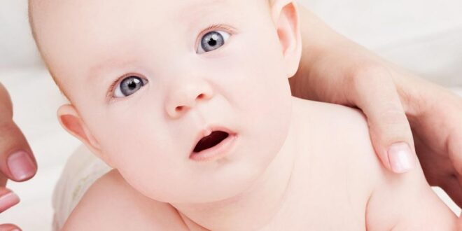Ocular Torticollis Symptoms, Causes, Test, Treatment