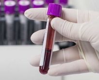 Absolute immature granulocyte Test Normal, High & Low Ranges